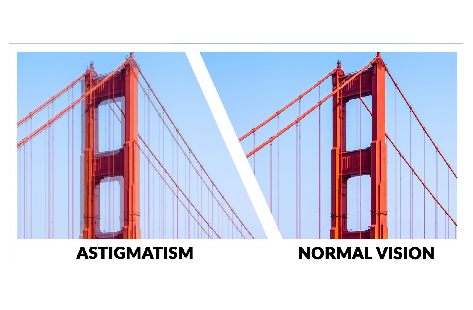 How Do Eye Doctors Test for Astigmatism? | Fountain Valley